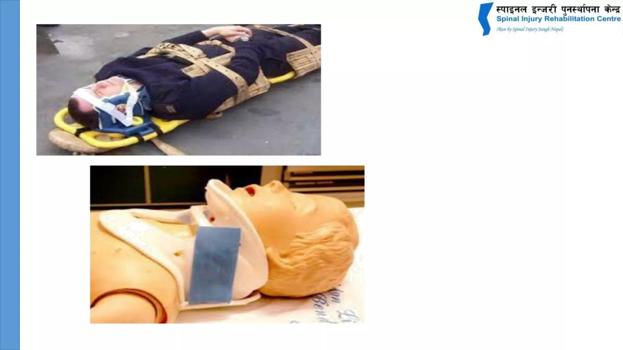 Trauma management protocol (ABCDE) | PPTX