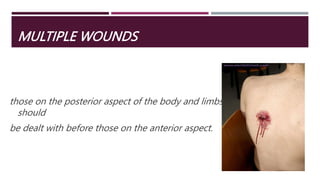 trauma.ppt