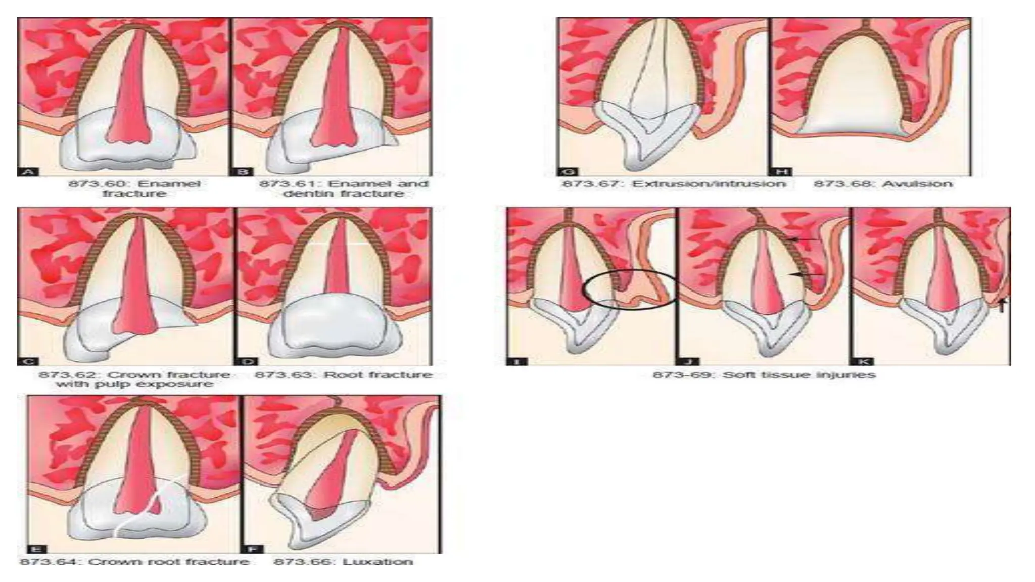trauma to permanent teeth slide show.pptx