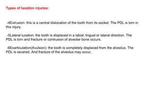 trauma to permanent teeth slide show.pptx | Death, Injury, or Military ...
