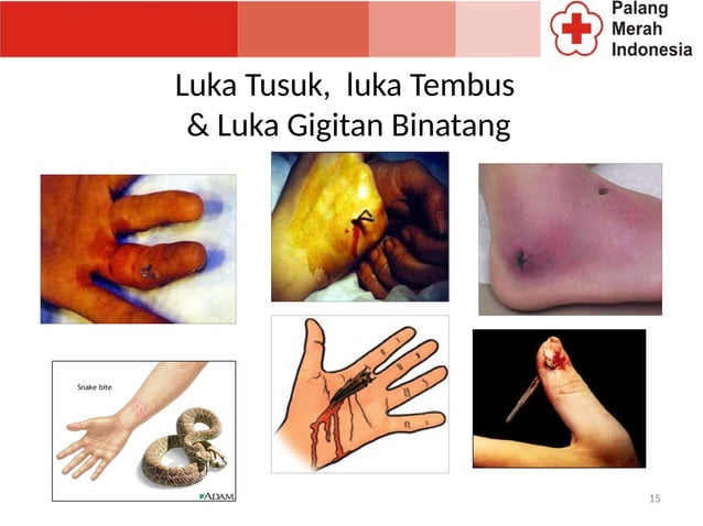 Medis Dasar Trauma dan cara memberikan pertolongannya.pptx