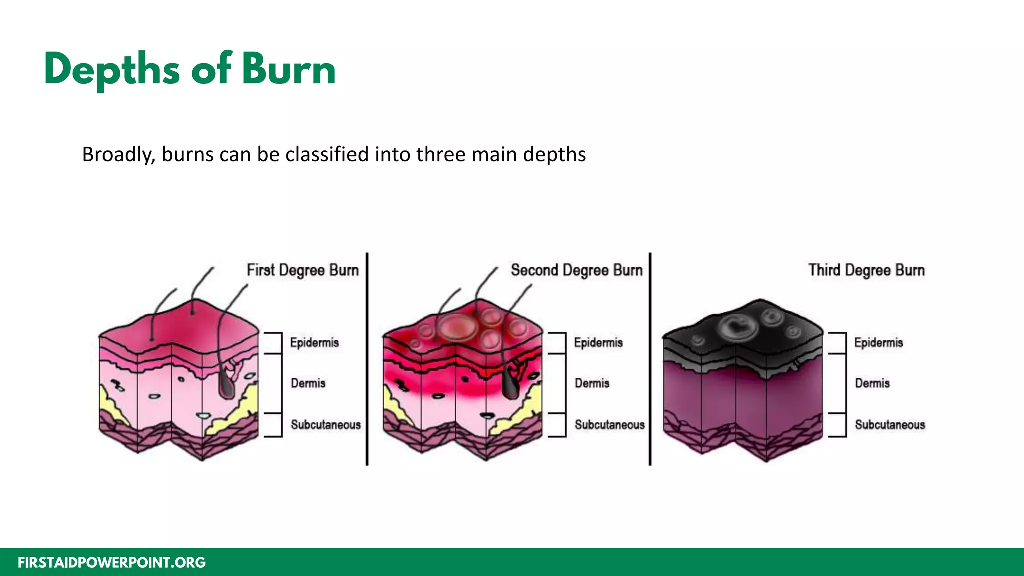 Trauma - Burn Injuries | PPTX