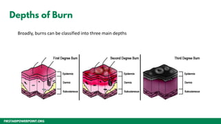 Trauma - Burn Injuries | PPTX