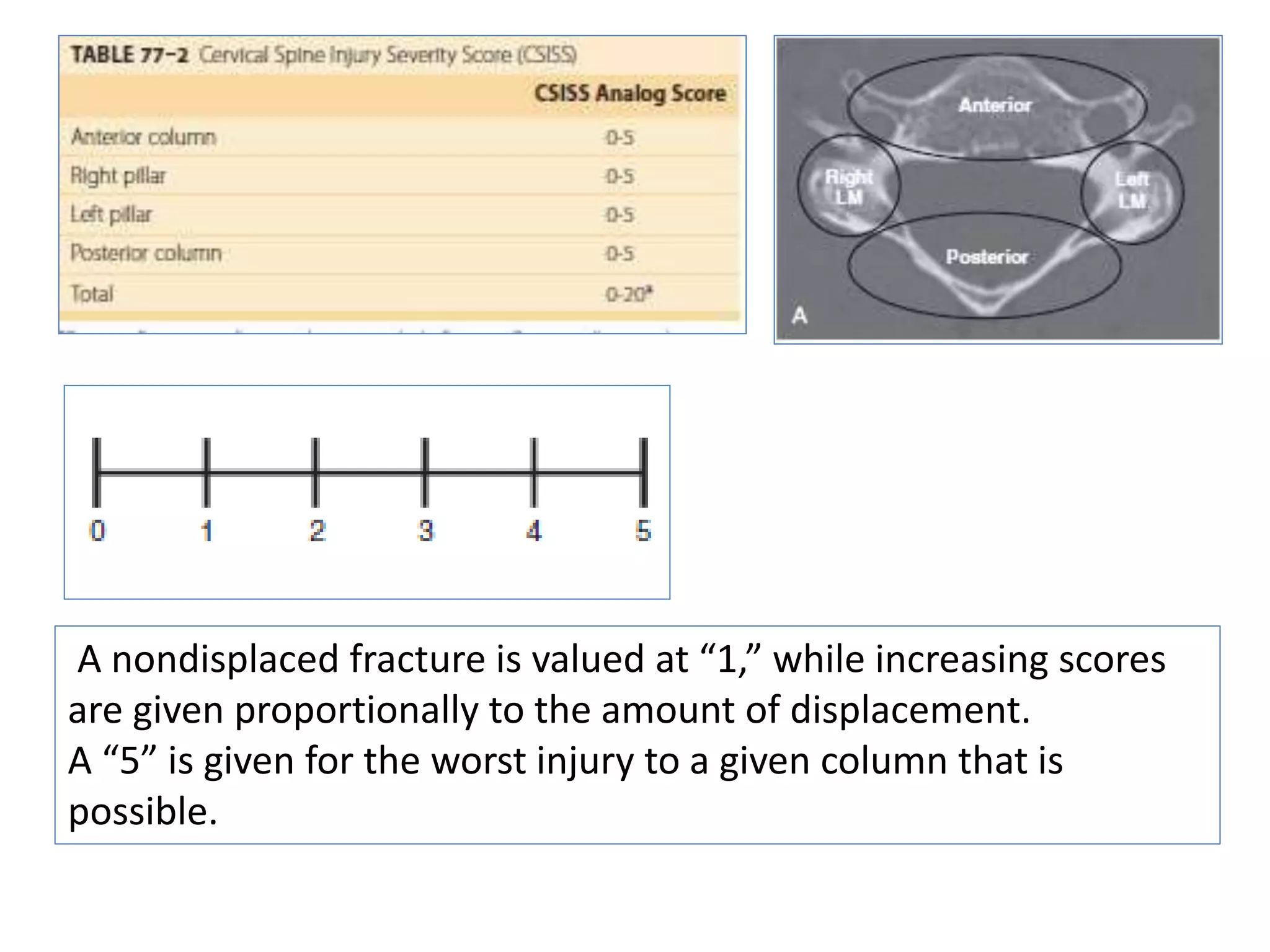 cervical Trauma classification | PPTX