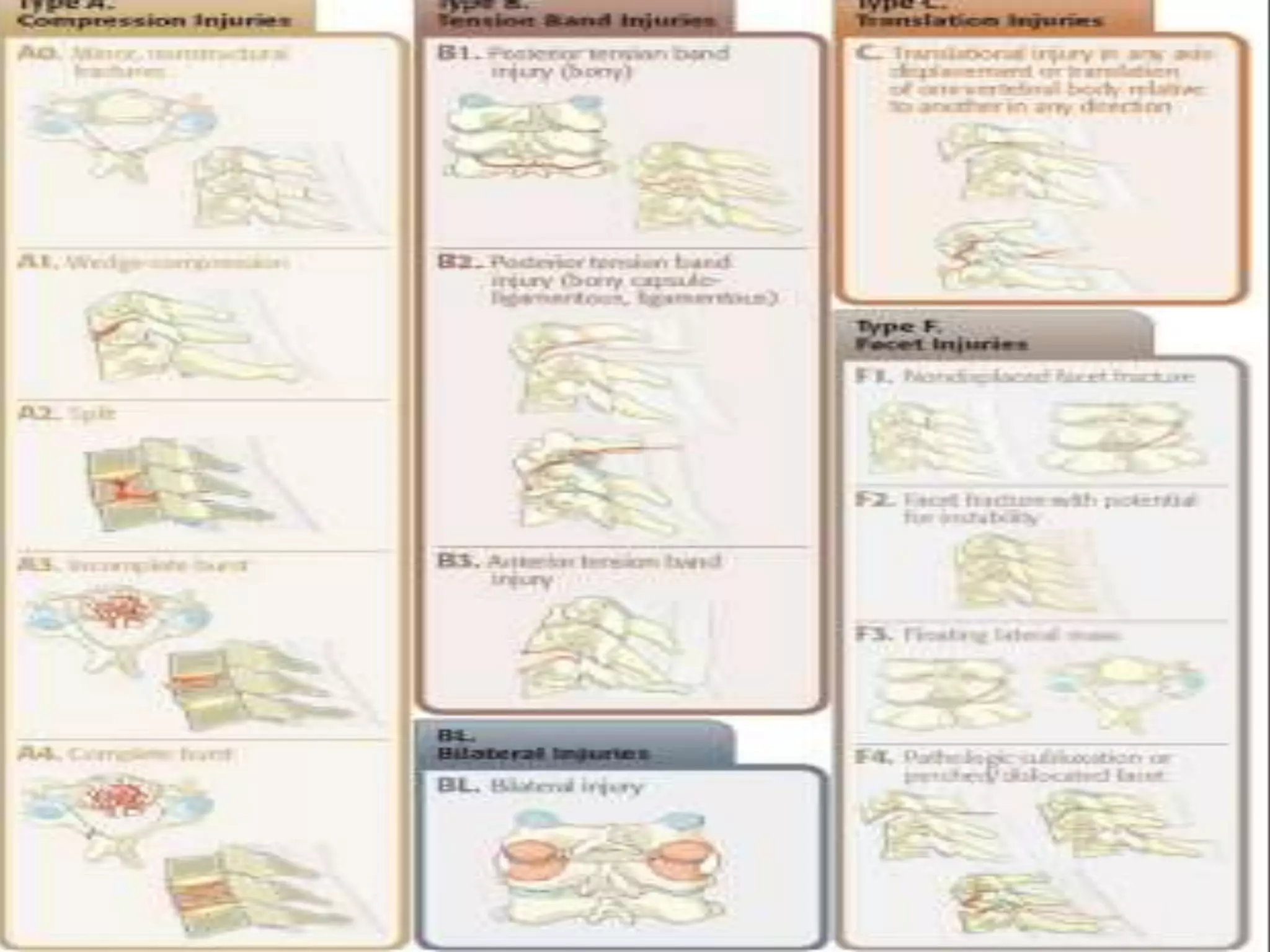 cervical Trauma classification | PPTX