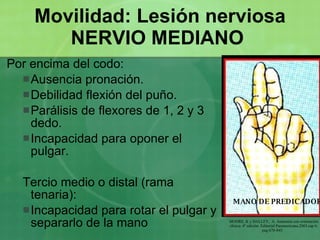 Trauma De Mano | PPT