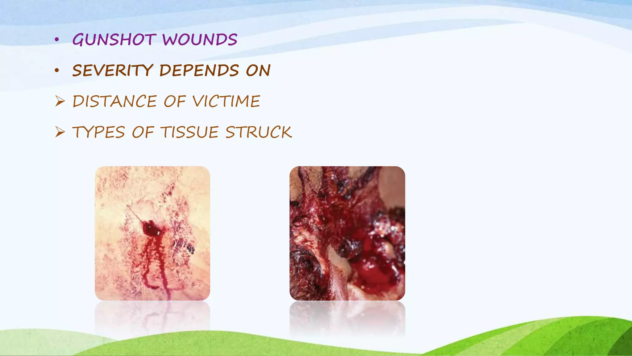 MANAGEMENT OF TRAUMA | PPTX