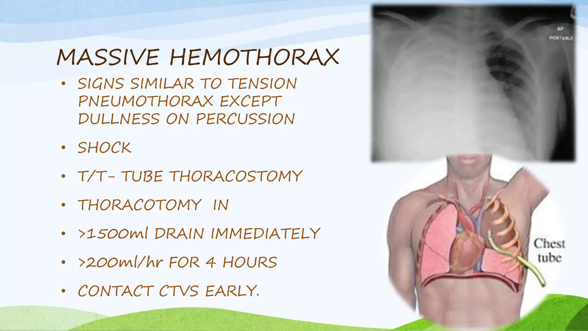 MANAGEMENT OF TRAUMA | PPTX