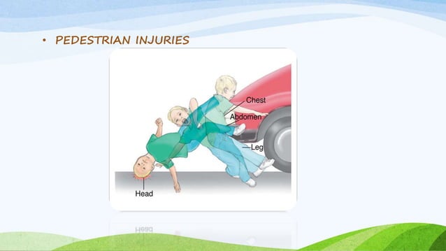 MANAGEMENT OF TRAUMA | PPTX | First Aid | Injuries
