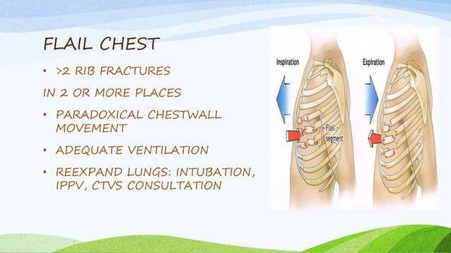 MANAGEMENT OF TRAUMA | PPTX | First Aid | Injuries