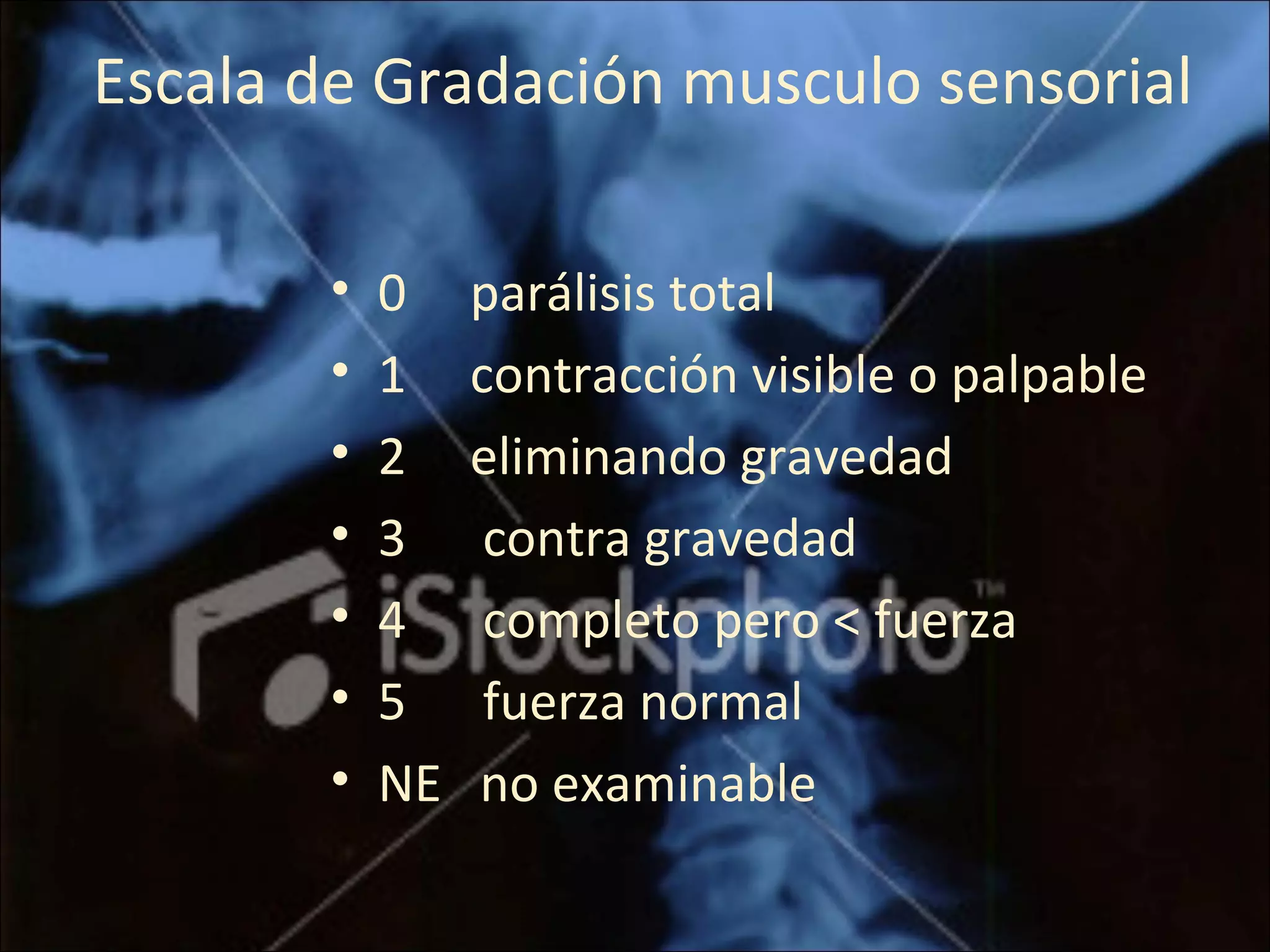 Trauma Medular | PPT