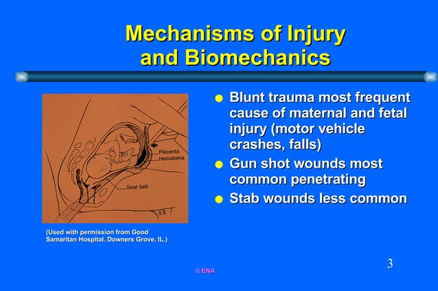 Trauma & Pregnancy | PPT