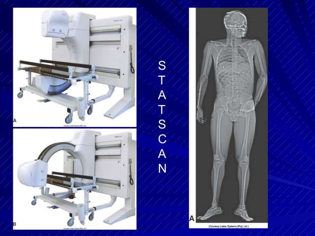 Trauma radiograph | PPT