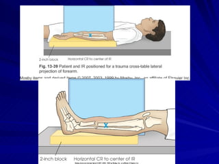 Trauma Radiography | PPT