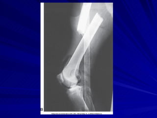 Trauma Radiography | PPT