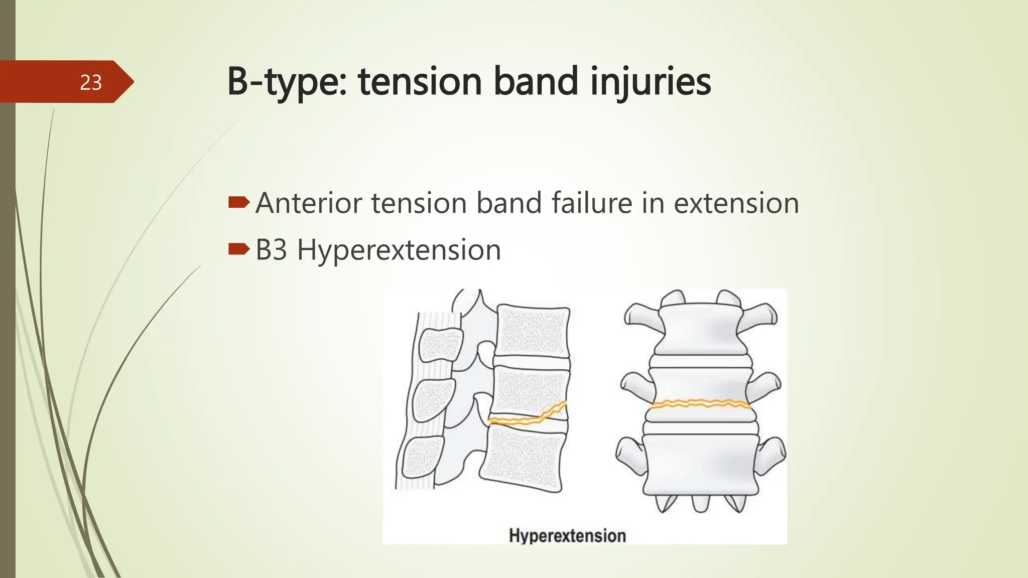 Trauma - Thoracic and chest injuries.pptx
