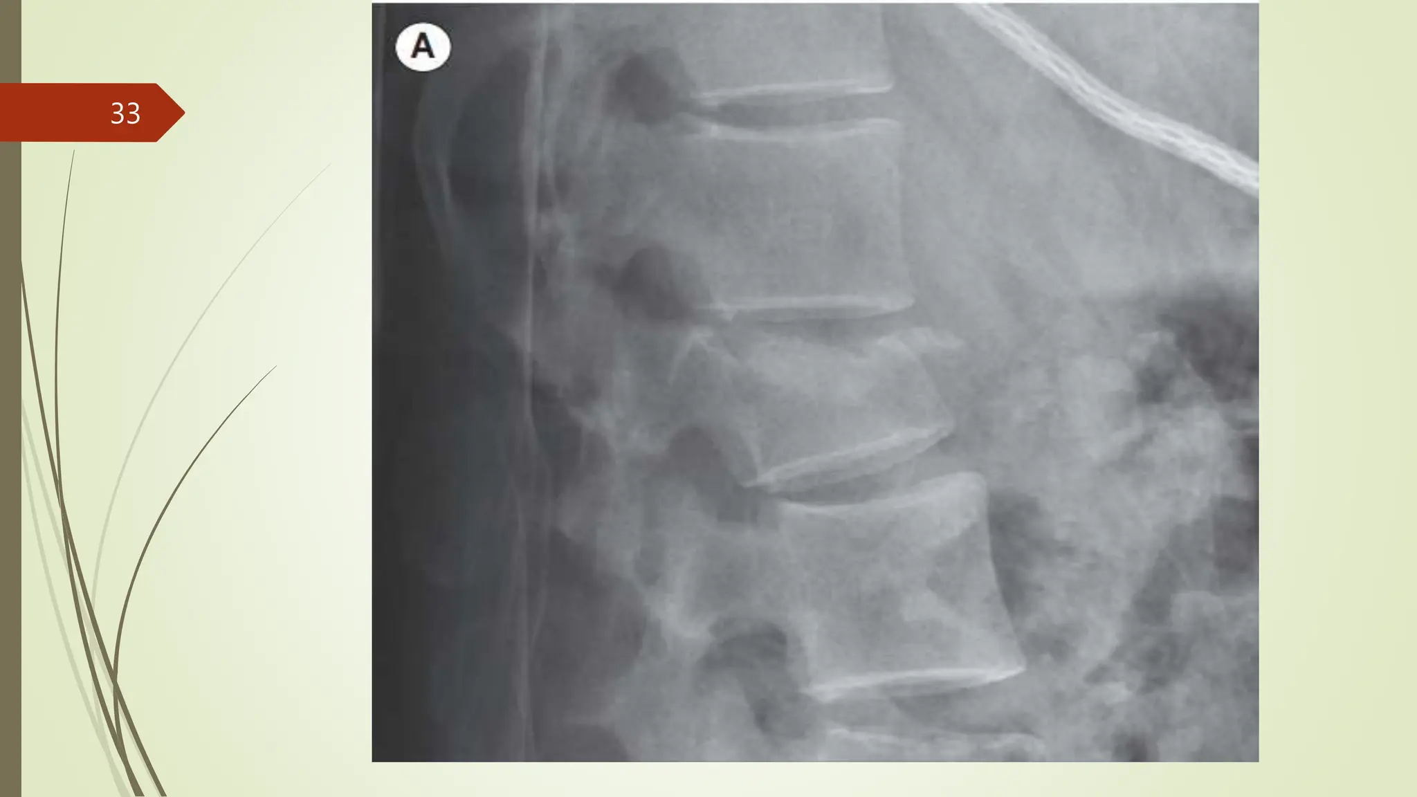 Trauma - Thoracic and chest injuries.pptx