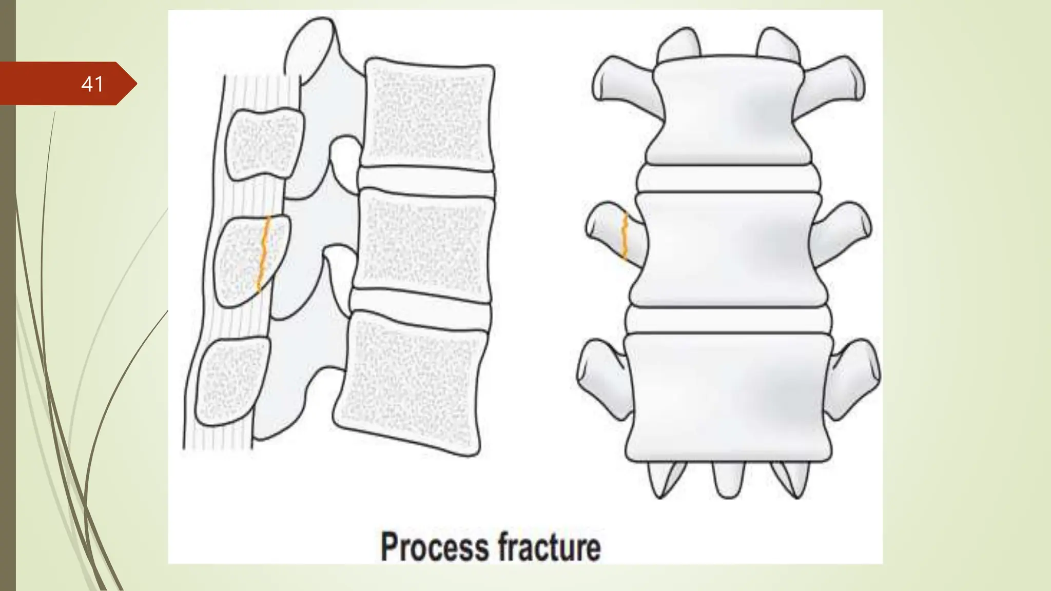Trauma - Thoracic and chest injuries.pptx