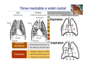 Trauma-torácico.pdf