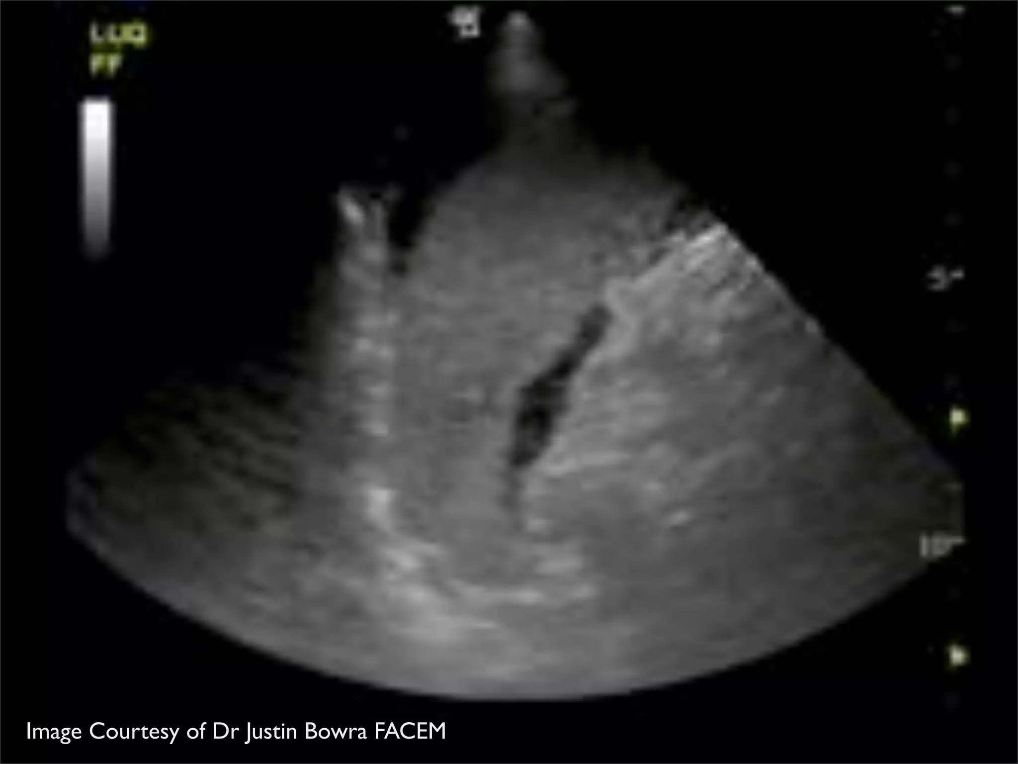 Trauma ultrasound | PDF