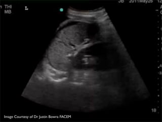Trauma ultrasound | PDF