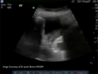 Trauma ultrasound | PDF