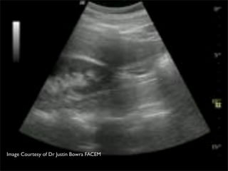Trauma ultrasound | PDF