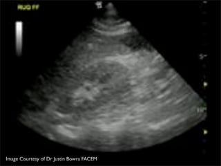 Trauma ultrasound | PDF