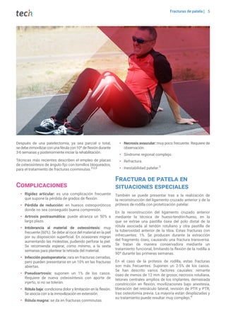 Fracturas de Patela | PDF