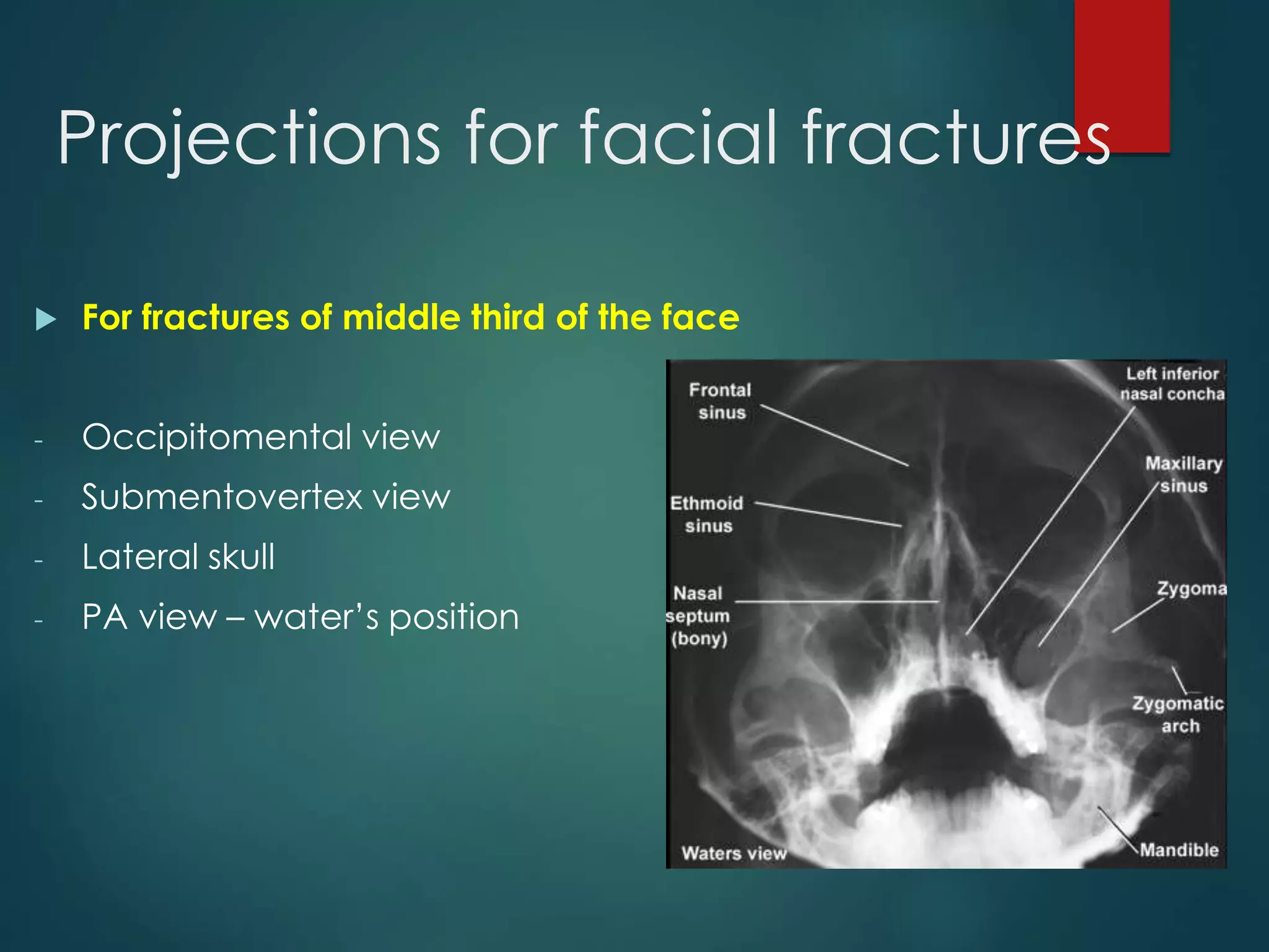 Radigraphic Imaging in Maxillofacial Trauma | PPTX