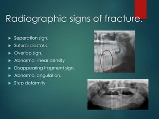 Radigraphic Imaging in Maxillofacial Trauma | PPTX