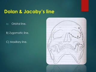 Radigraphic Imaging in Maxillofacial Trauma | PPTX