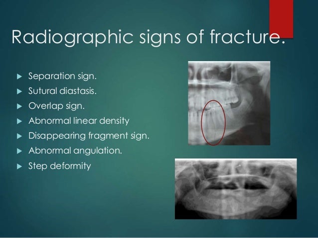 Radigraphic Imaging in Maxillofacial Trauma