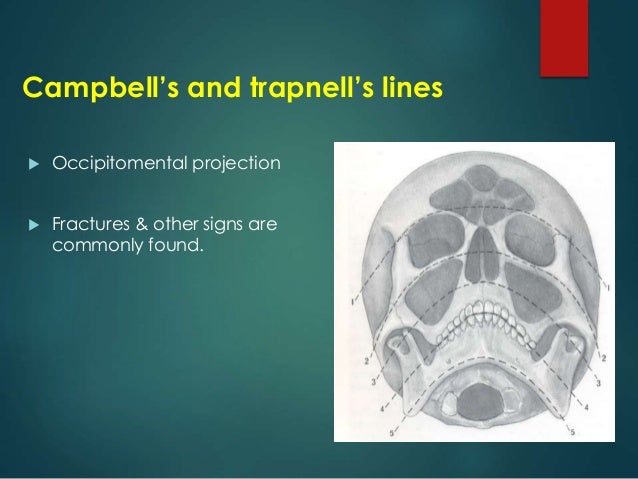 Radigraphic Imaging in Maxillofacial Trauma