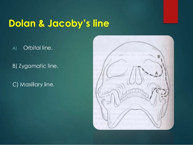 Radigraphic Imaging in Maxillofacial Trauma