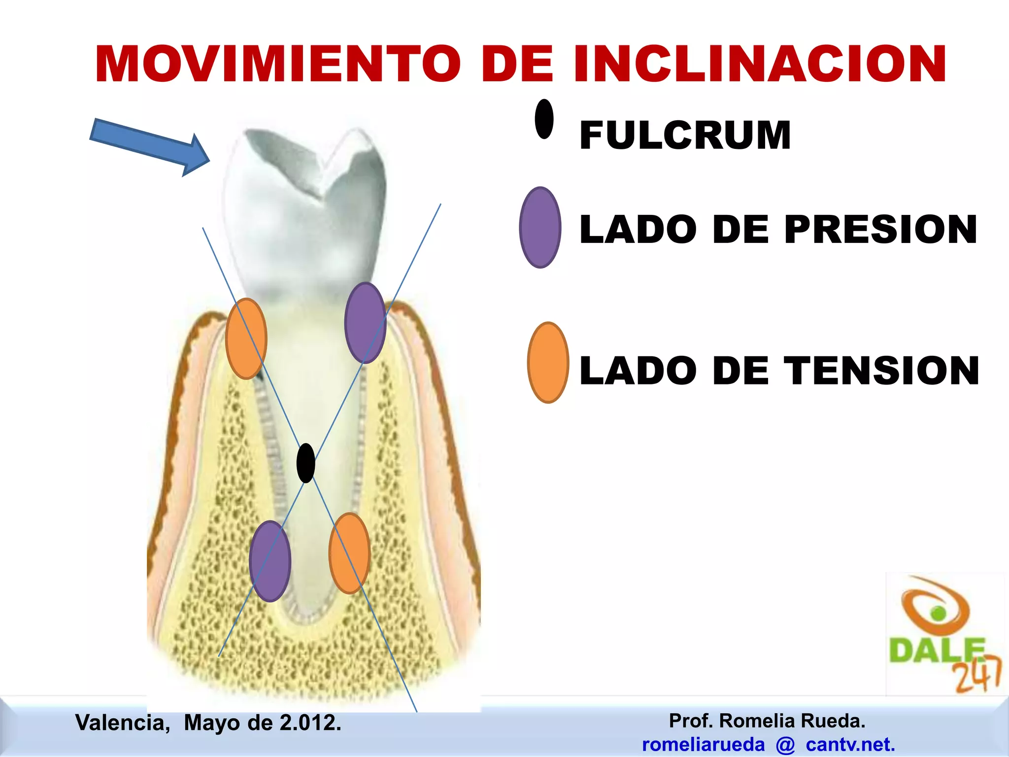 Trauma Oclusal Periodoncia | PPTX