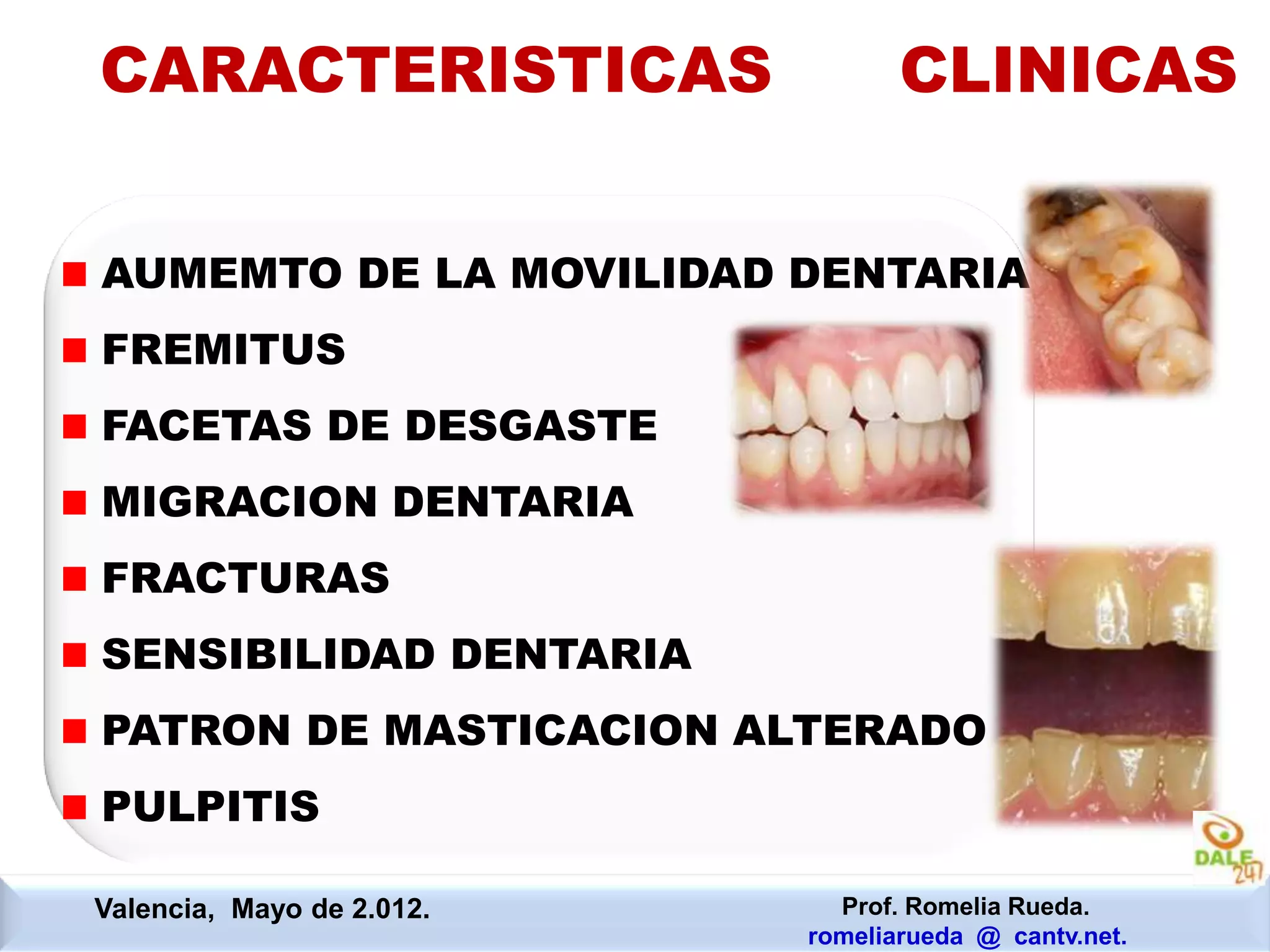 Trauma Oclusal Periodoncia | PPTX