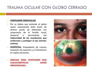 Trauma%20 ocular | PDF