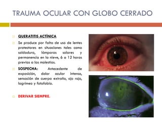 Trauma%20 ocular | PDF