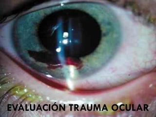 Trauma%20 ocular | PDF