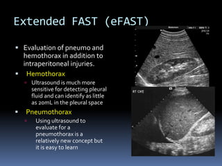 iMAGENOLOGIA EN TRAUMA ABDOINAL | PPSX