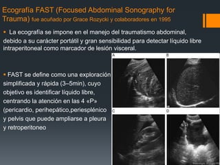 Trauma abdominal | PPTX