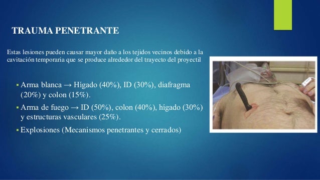 Trauma abdominal ATLS