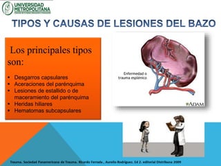 Trauma abdominal bazo | PPTX