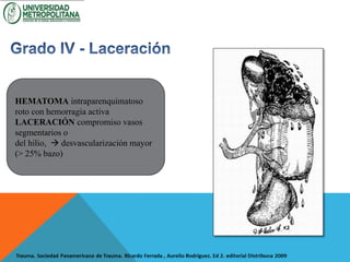 Trauma abdominal bazo | PPTX