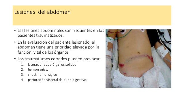 Trauma abdominal cerrado final