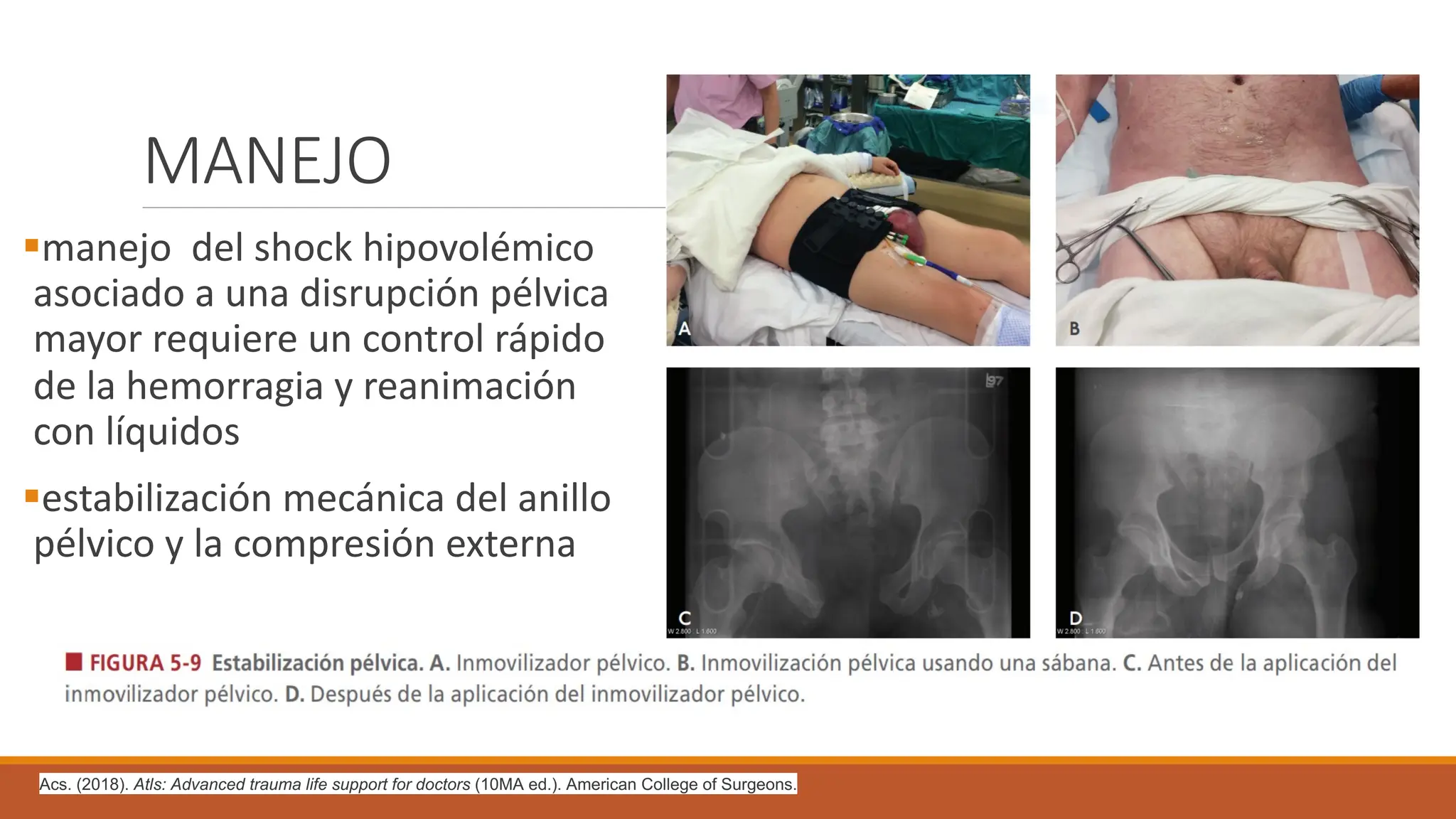 Trauma abdominal y pélvico segun Atls pdf | PDF