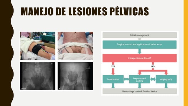 TRAUMA ABDOMINO PELVICO.pptx
