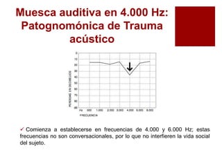 Trauma acústico | PPTX