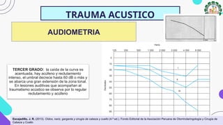 TRAUMA ACUSTICO-2.pptx Salud ocupacional | PPTX